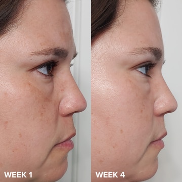 SKIN PERFECTING 2% BHA Liquid Exfoliant | Paula's Choice