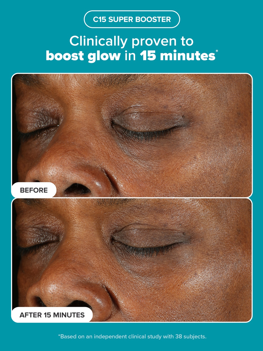 Clarify, Even & Brighten Kit | Paula's Choice