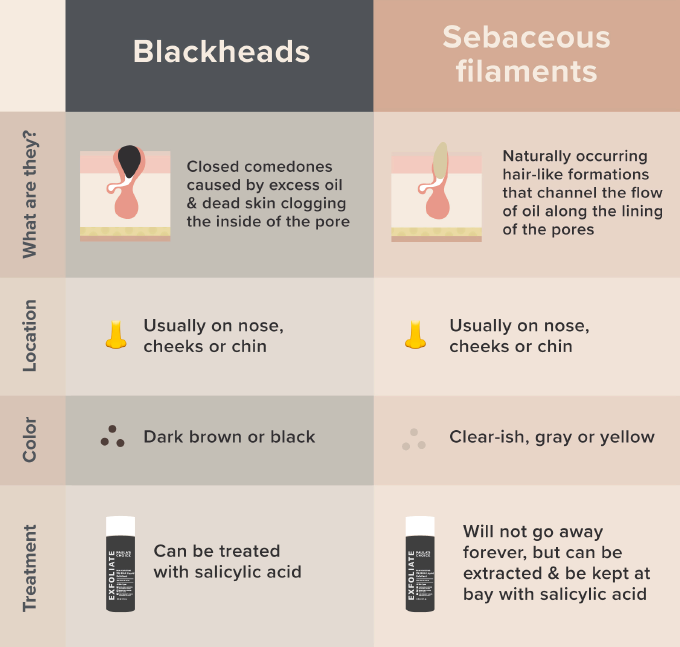 Sebaceous Filaments vs. Blackheads - What's the Difference? | Paula's Choice